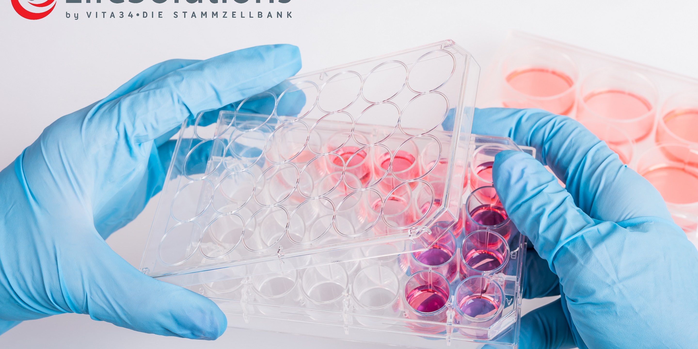 Celulele stem hematopoietice – ajutorul în lupta cu boala - LifeSolutions